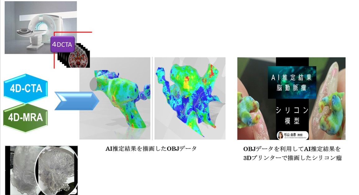 4D-CTA・4D-MRA医療画像に基づく壁微小運動の数理解析とAI 技術の融合～先制医療のための数理データ科学統合シミュレーション～ (Mathematical Analysis of ...